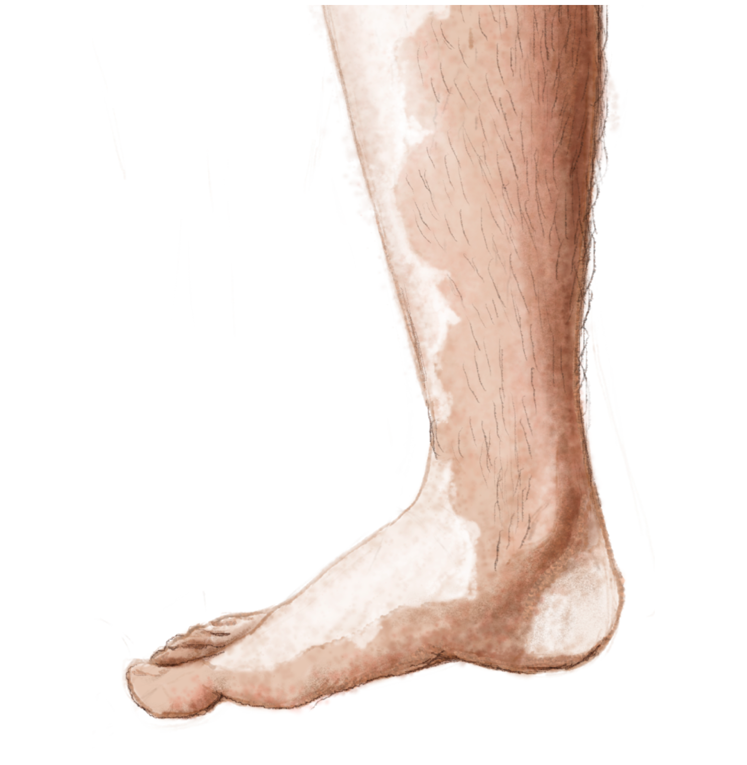 Krankheitssymptome: Auf den ersten Blick | ZEIT ONLINE