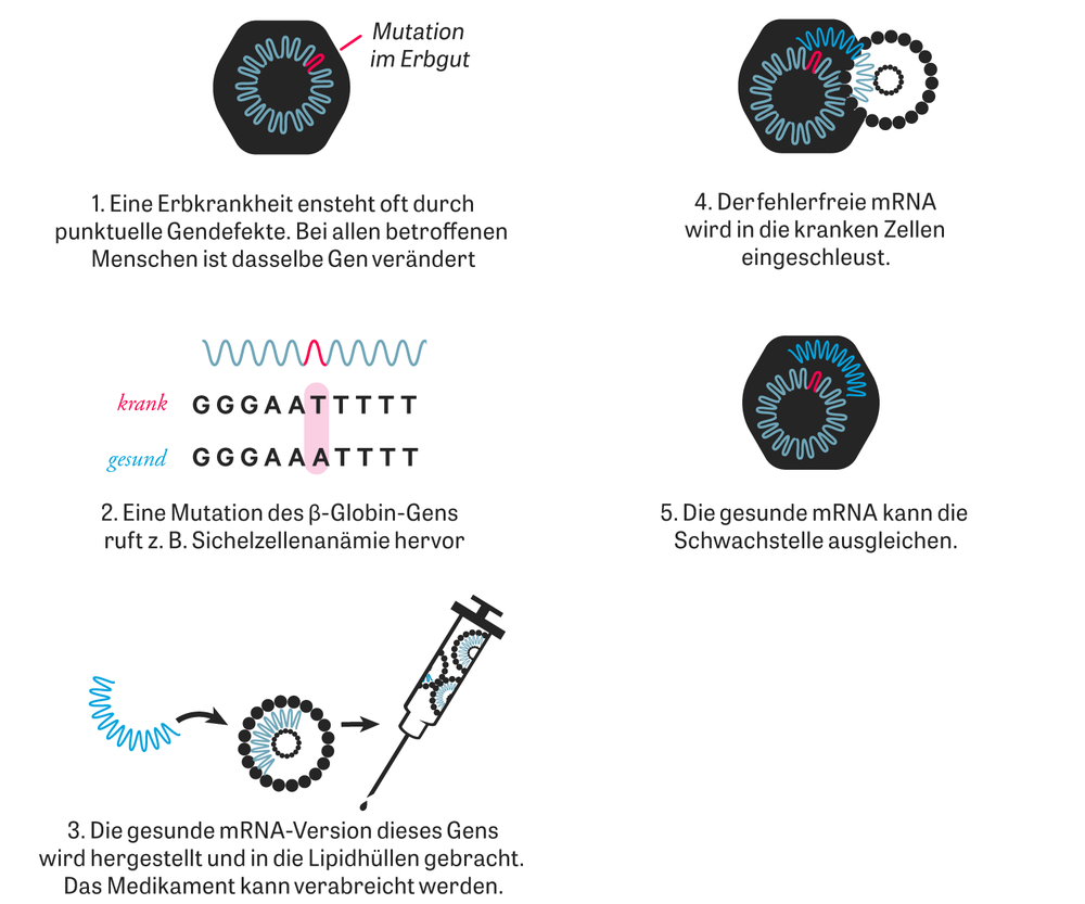 mRNA-Impfstoffe: Impfen mit Informationen – So funktioniert es | DIE ZEIT