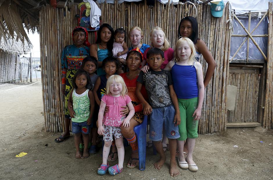 Albinismus: Die Kinder des Mondes | ZEIT ONLINE
