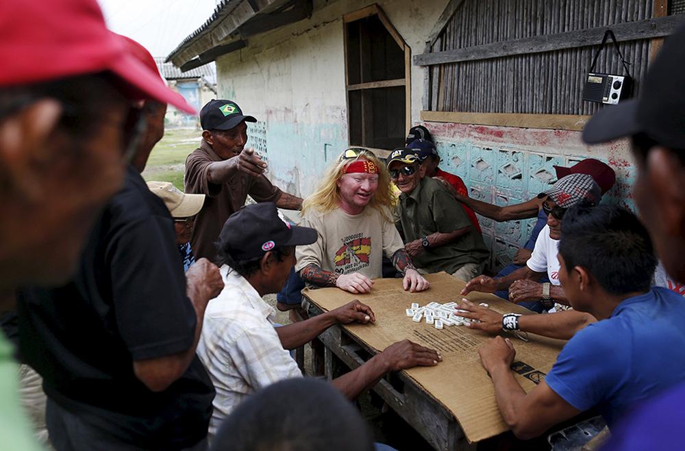 Albinismus: Die Kinder des Mondes | ZEIT ONLINE