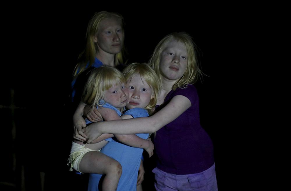 Albinismus: Die Kinder des Mondes | ZEIT ONLINE