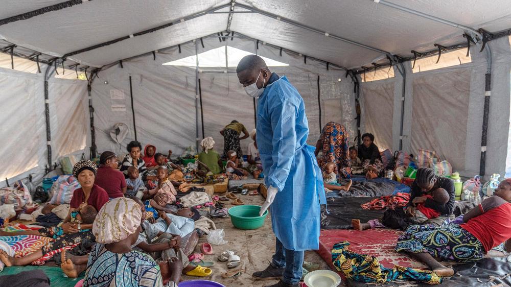 Mpox-Virus: Mpox breitet sich in der Demokratischen Republik Kongo aus ...