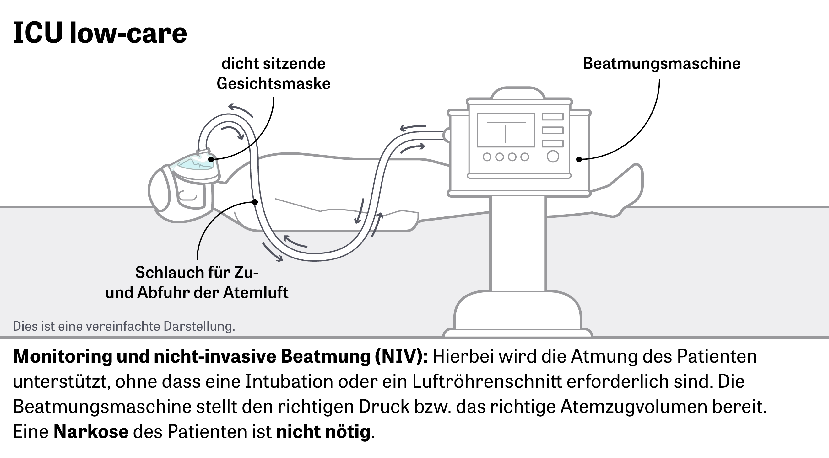 Beatmungstherapie: Wenn eine Maschine die Atmung übernimmt | ZEIT ONLINE
