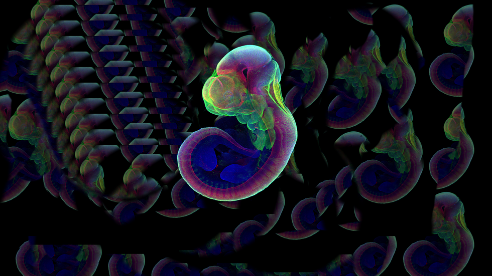 Vielleicht Der Erste Menschliche Embryo Aus Dem Labor – IXXLIQ